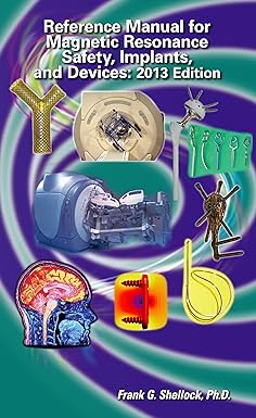 Amazon | Reference Manual for Magnetic Resonance Safety Implants and ...