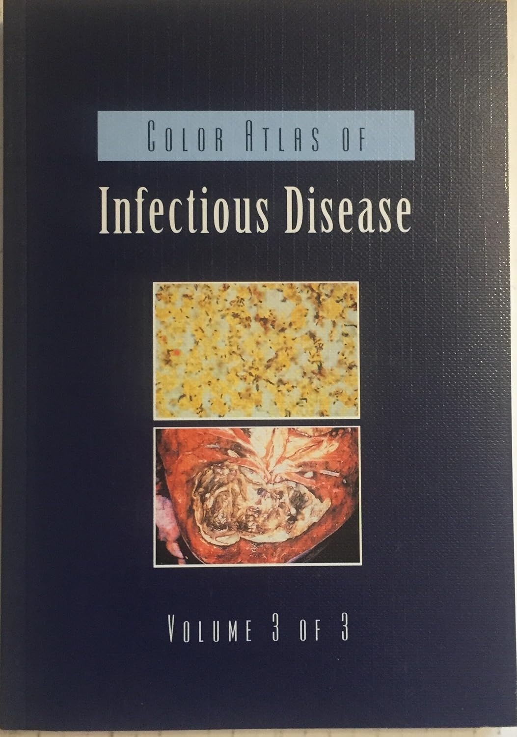 Color Atlas of Infectious Disease (Volume 3 of 3): Et al Cimis, Robert ...