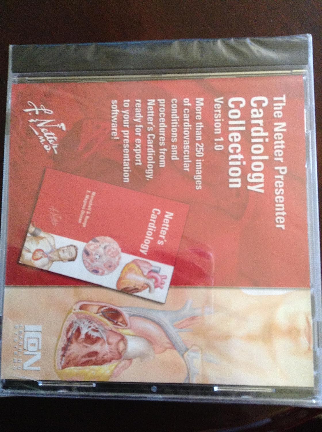 Cardiology Collection (The Netter Presenter): Frank H. Netter ...