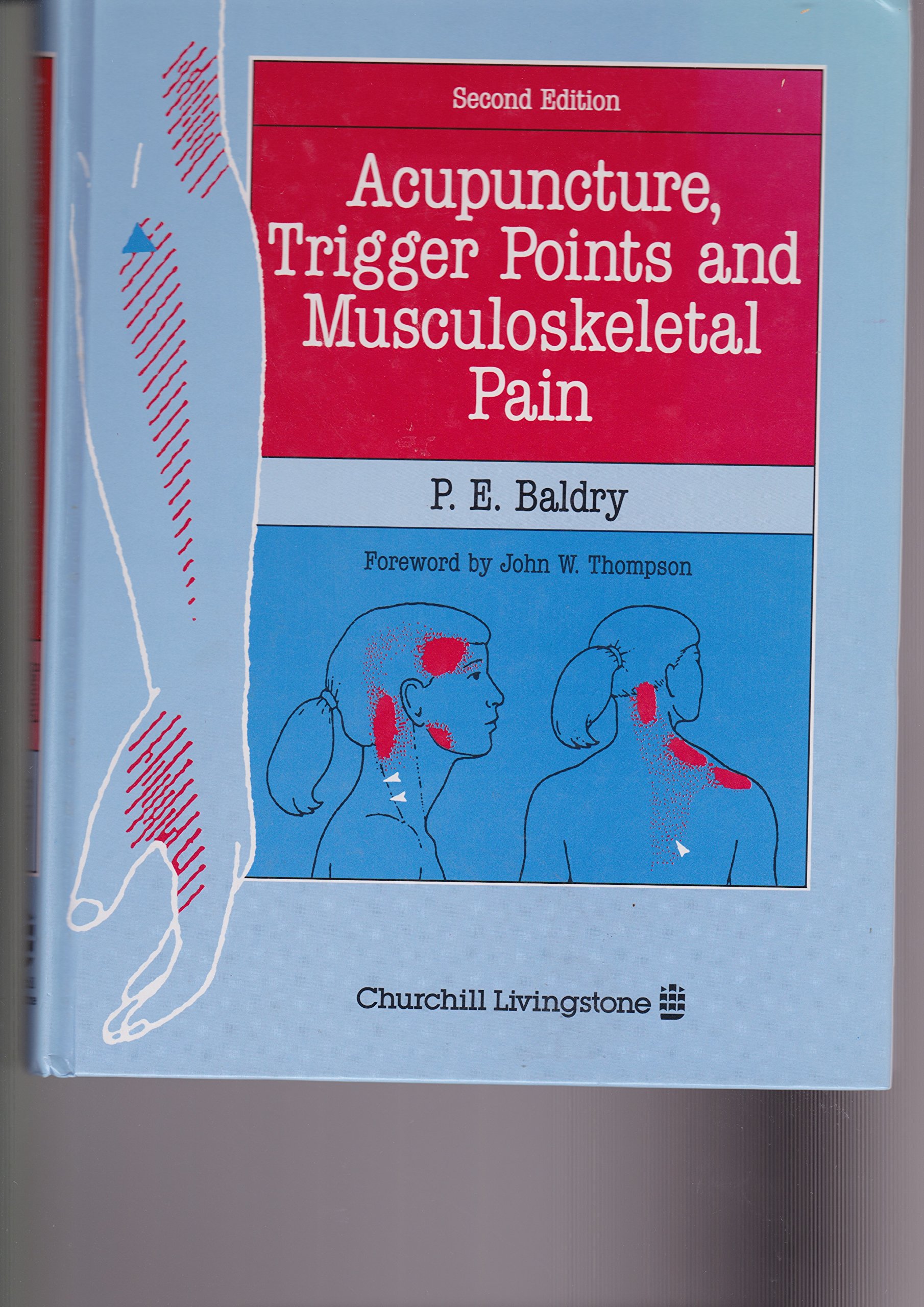 Acupuncture, Trigger Points and Musculoskeletal Pain: A Scientific ...