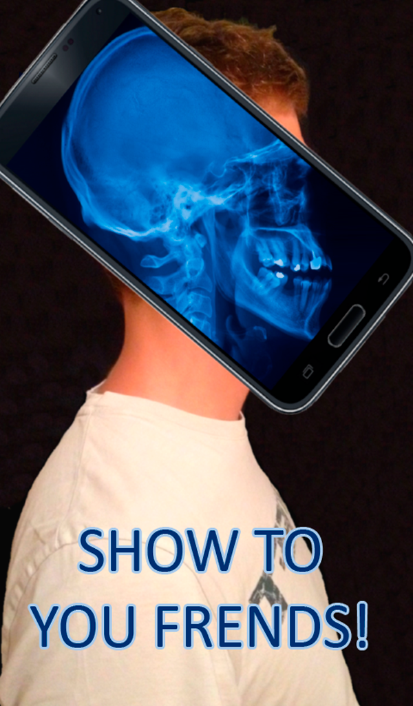 Best X-Ray Simulator - App on Amazon Appstore