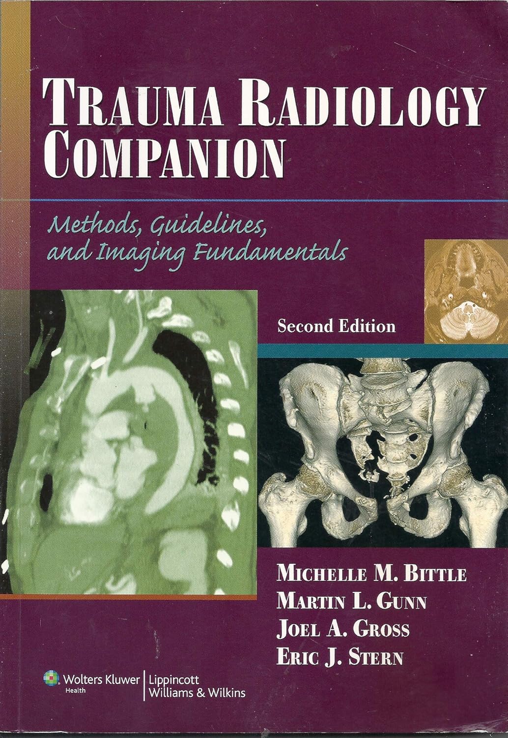 Buy Trauma Radiology Companion: Methods, Guidelines, and Imaging ...