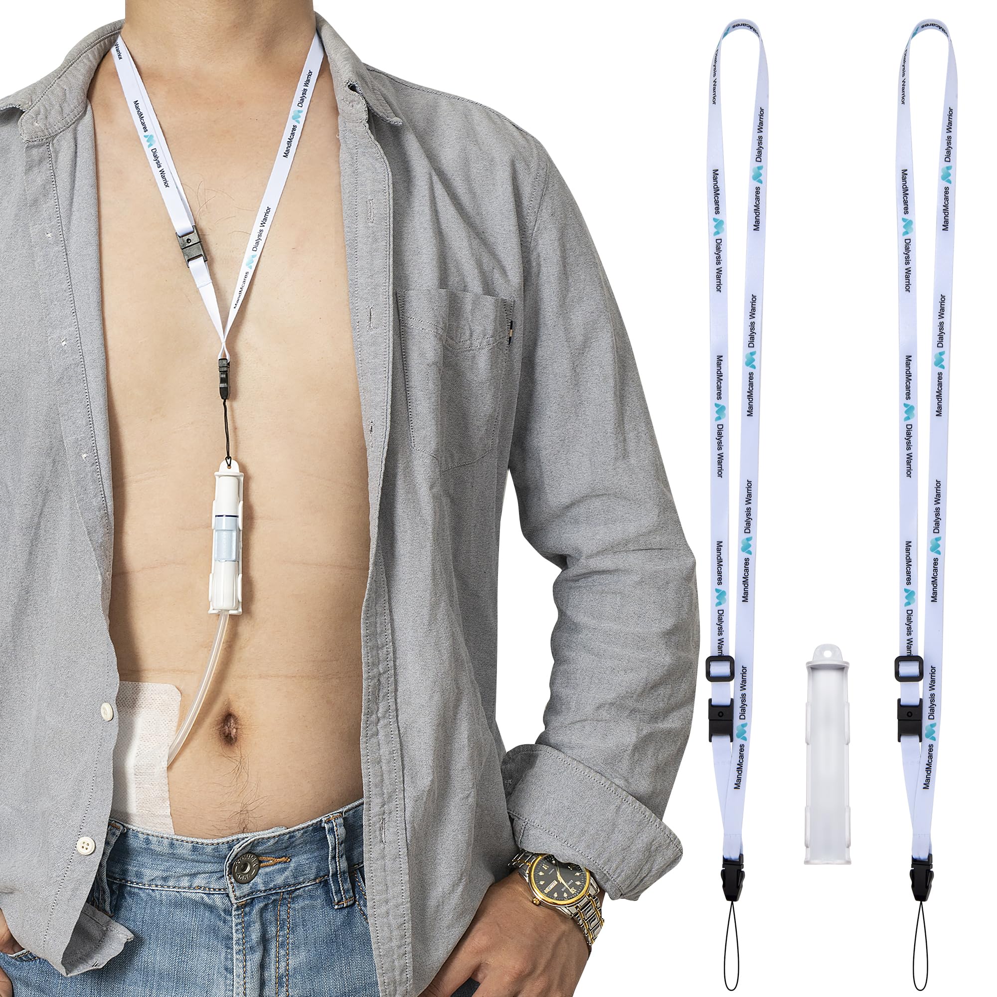 Cateter De Dialise Peritoneal Peritoneale Dialyse (PD) Katheters