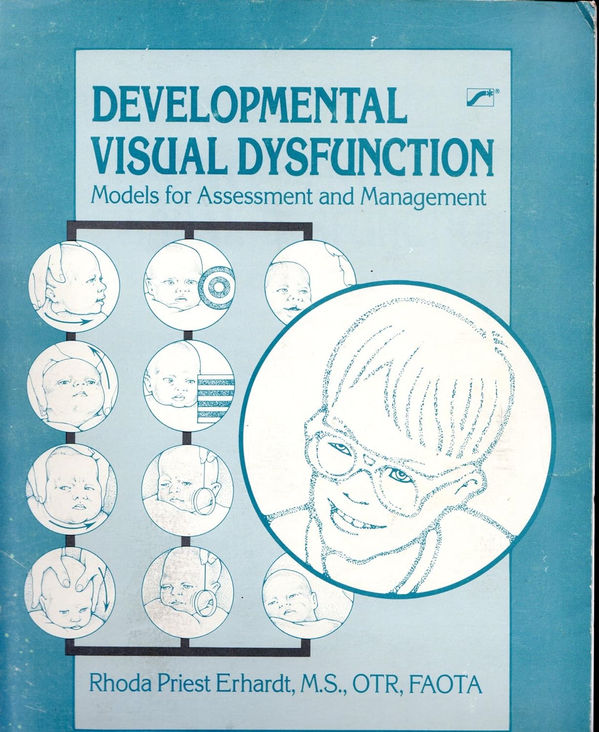 Developmental Visual Dysfunction: Models for Assessment and Management ...