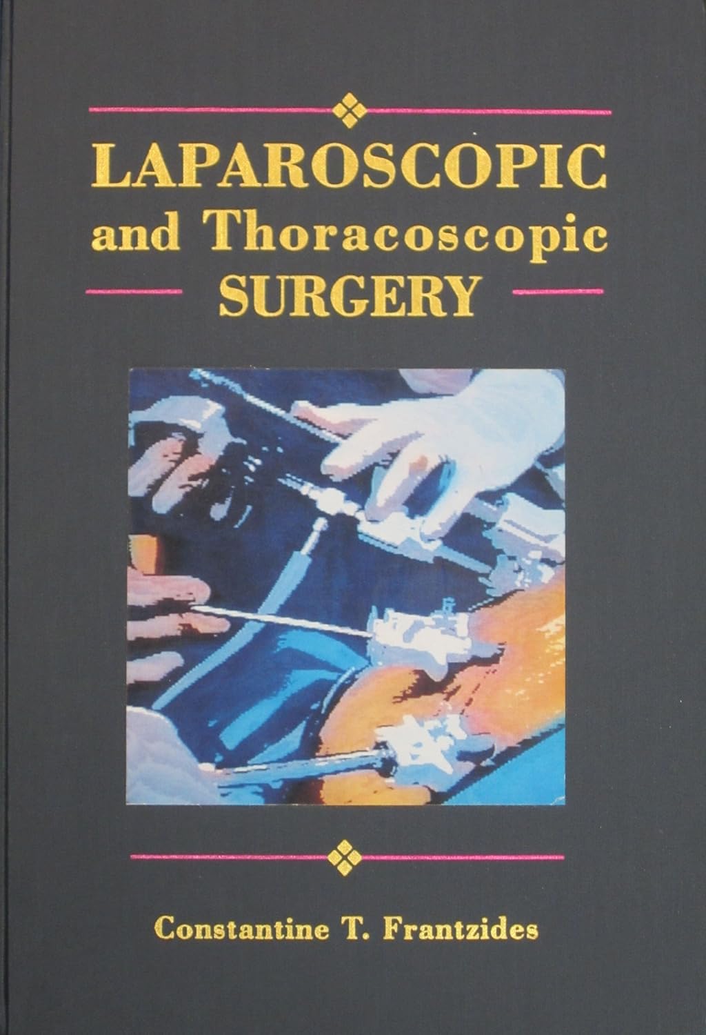 Laparoscopic and Thoracoscopic Surgery: Frantzides, Constantine T ...