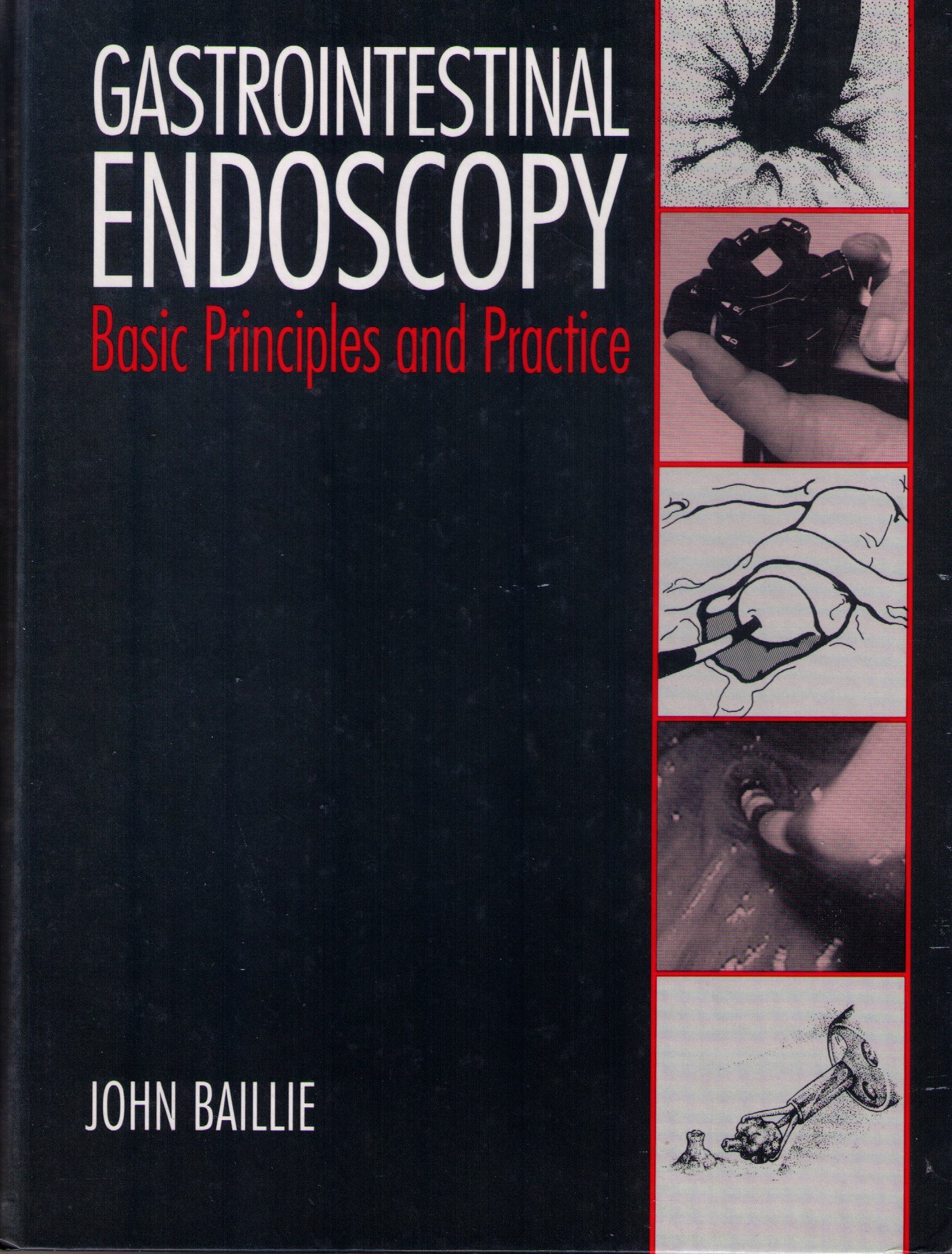 Gastrointestinal Endoscopy: Basic Principles and Practice ...