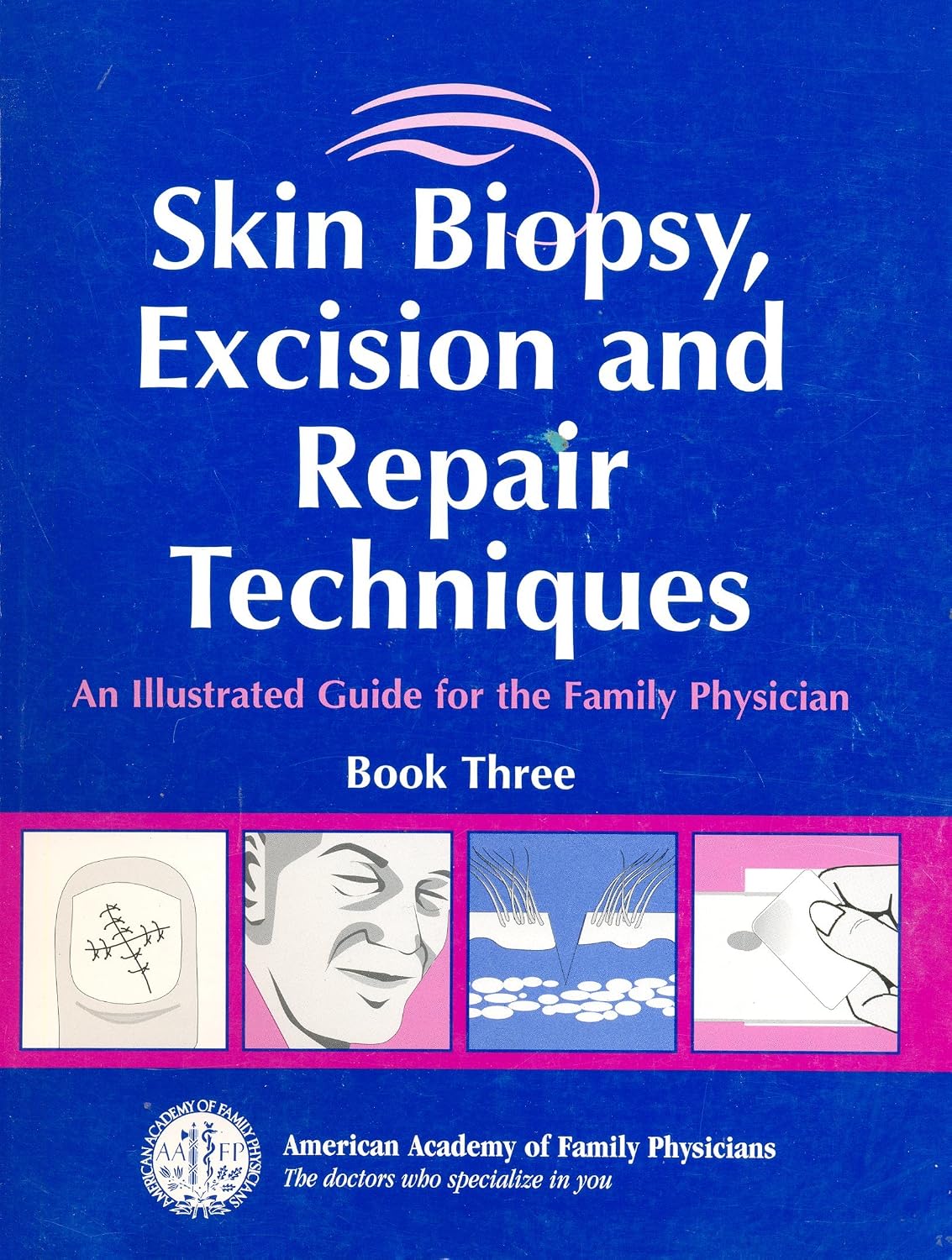 Skin Biopsy, Excision and Repair Techniques: An Illustrated Guide for ...