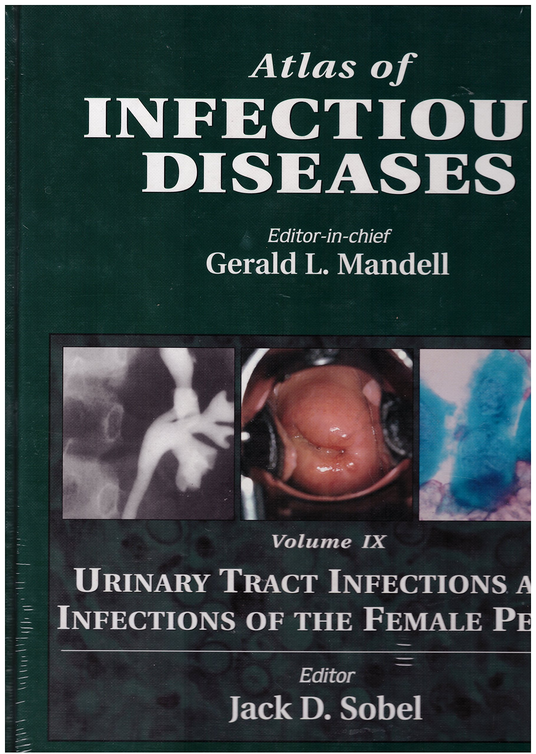 Atlas of Infectious Diseases: Urinary Tract Infections and Infections ...