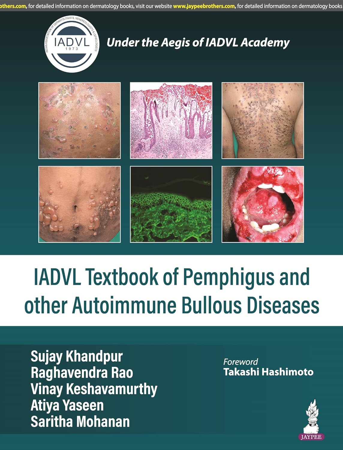 Textbook of Pemphigus and other Autoimmune Bullous Diseases ...