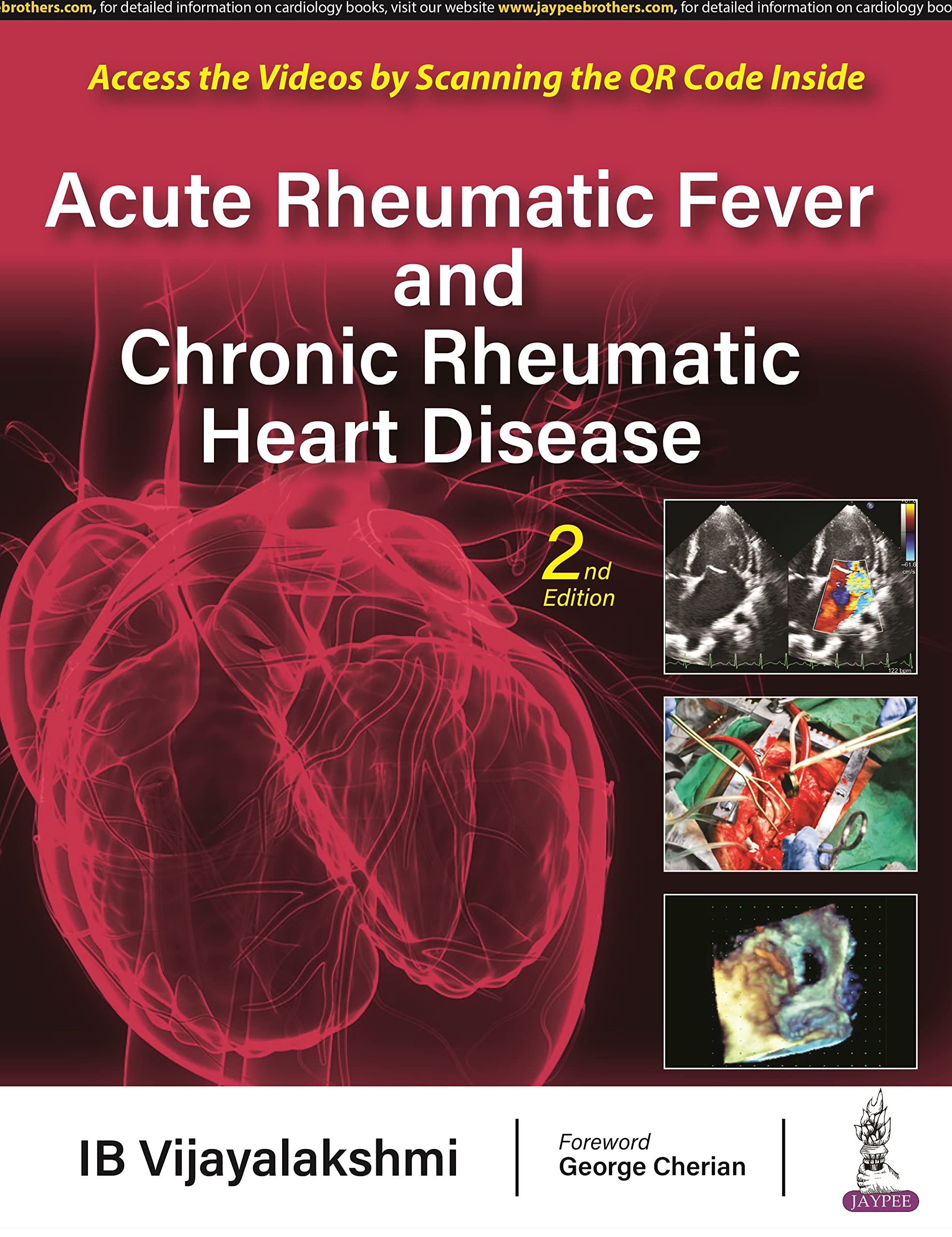 Acute Rheumatic Fever and Chronic Rheumatic Heart Disease ...