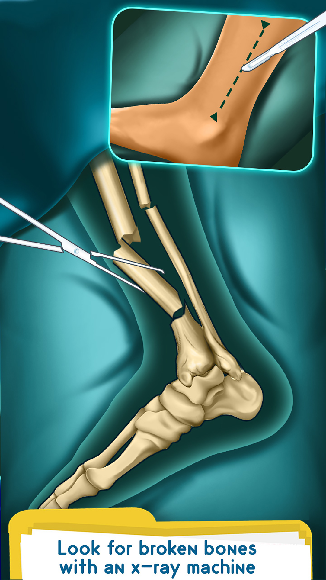 Foot Hospital Doctor Care Game : Emergency Surgery Simulator - App on ...