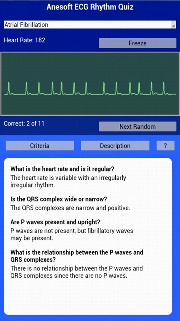 ECG Rhythms Quiz - App on Amazon Appstore