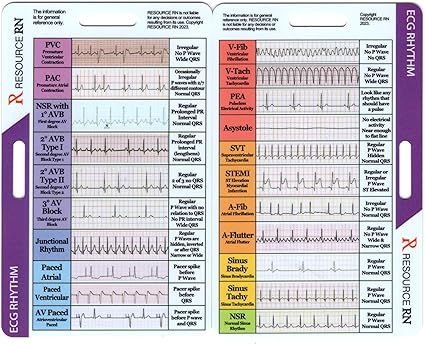 Amazon.com: EKG Rhythm Interpretation - Compact & Portable Reference ...