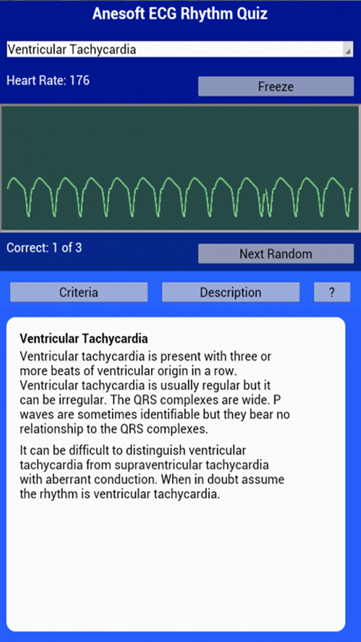 ECG Rhythms Quiz:Amazon.de:Appstore for Android