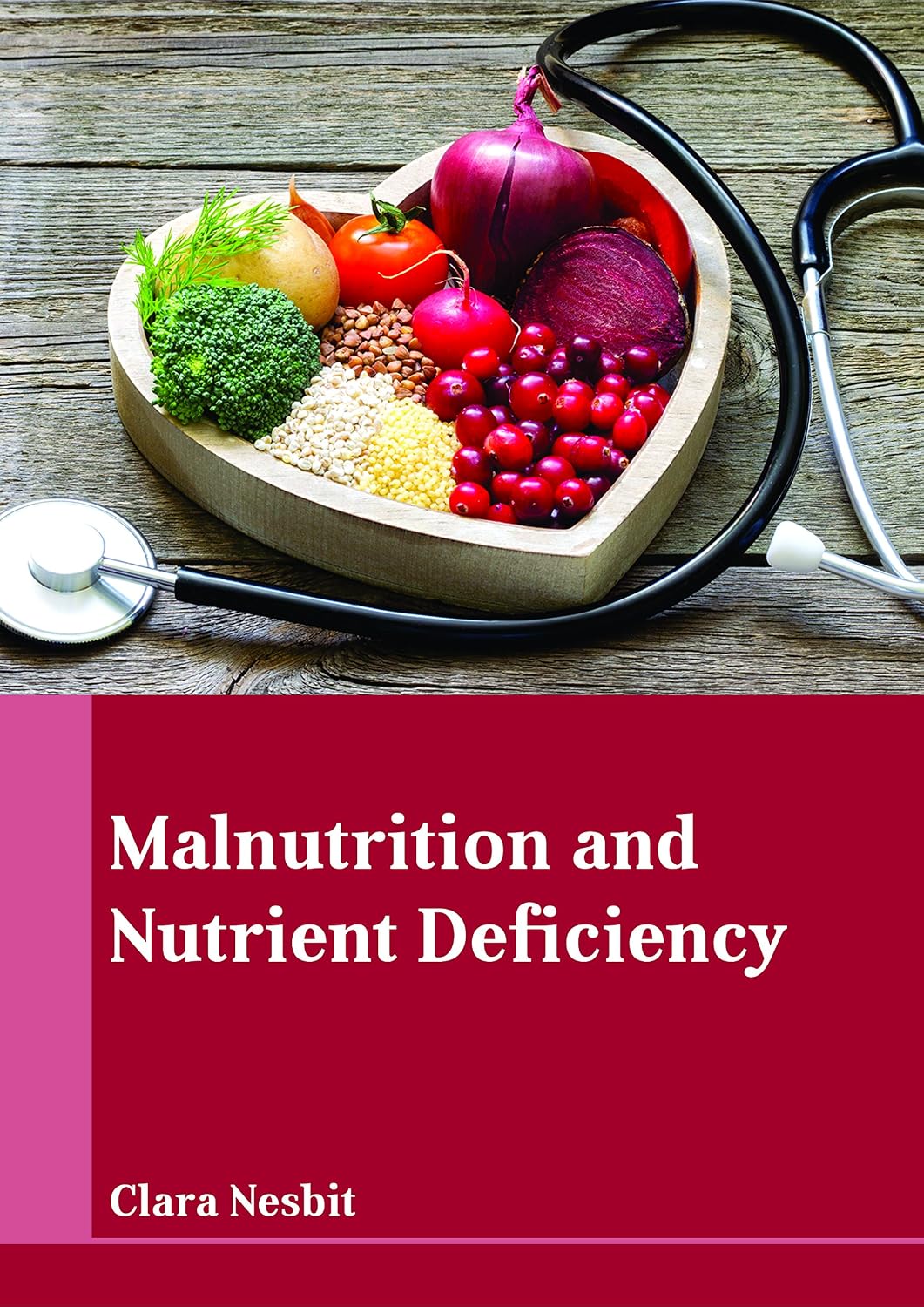 Malnutrition and Nutrient Deficiency: Nesbit, Clara: 9781635496994 ...