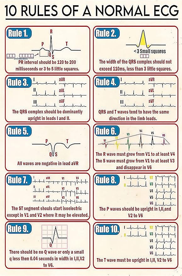 Amazon.com: posters 10 Rules Of A Normal Ecg: Posters & Prints