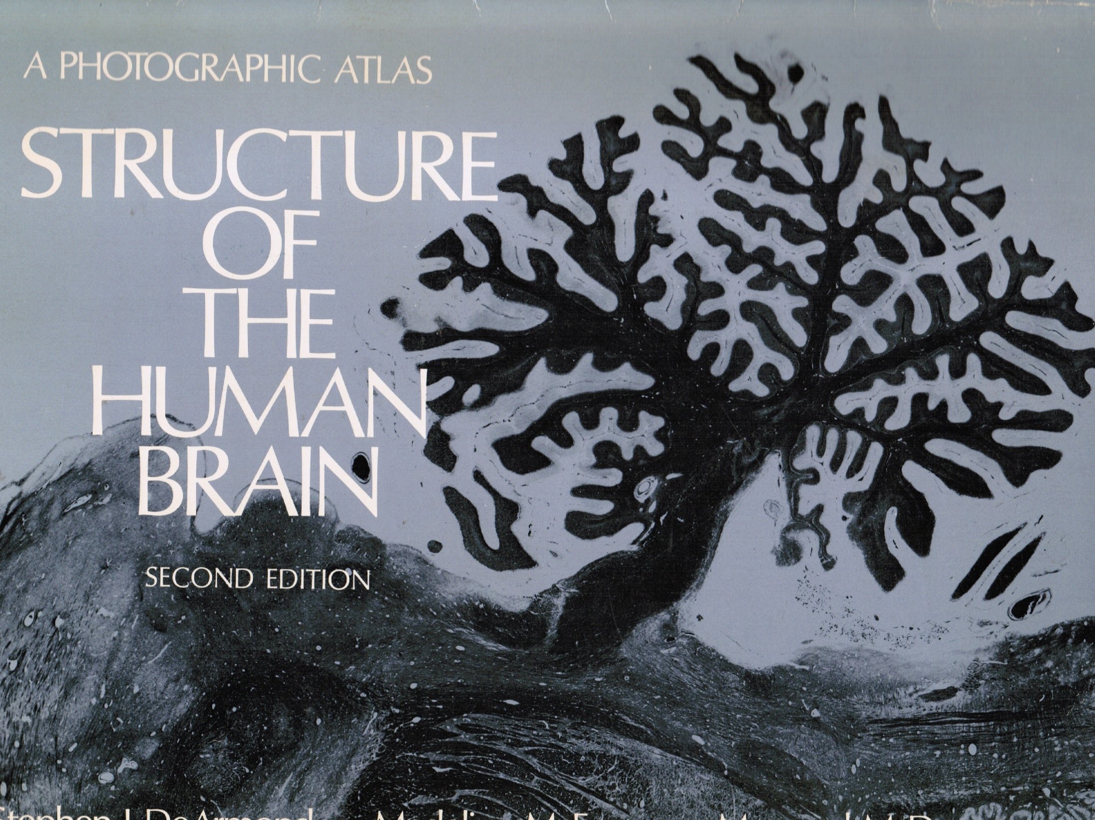 Structure of the Human Brain: A Photographic Atlas: 9780195043570 ...