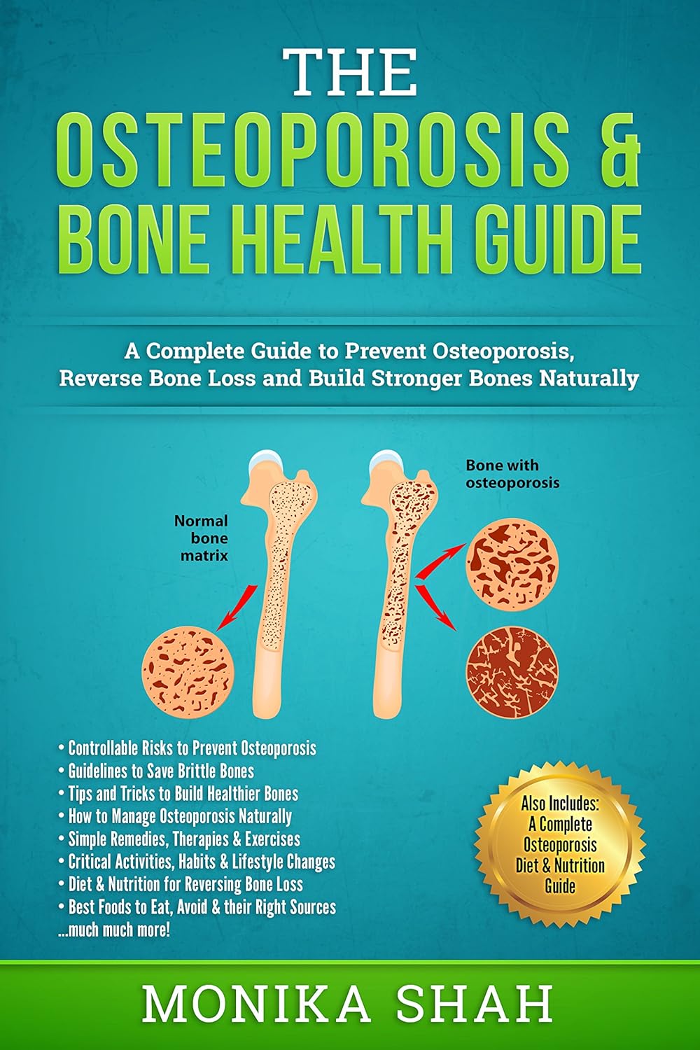 Osteoporosis: The Osteoporosis & Bone Health Guide: A Complete Guide to ...