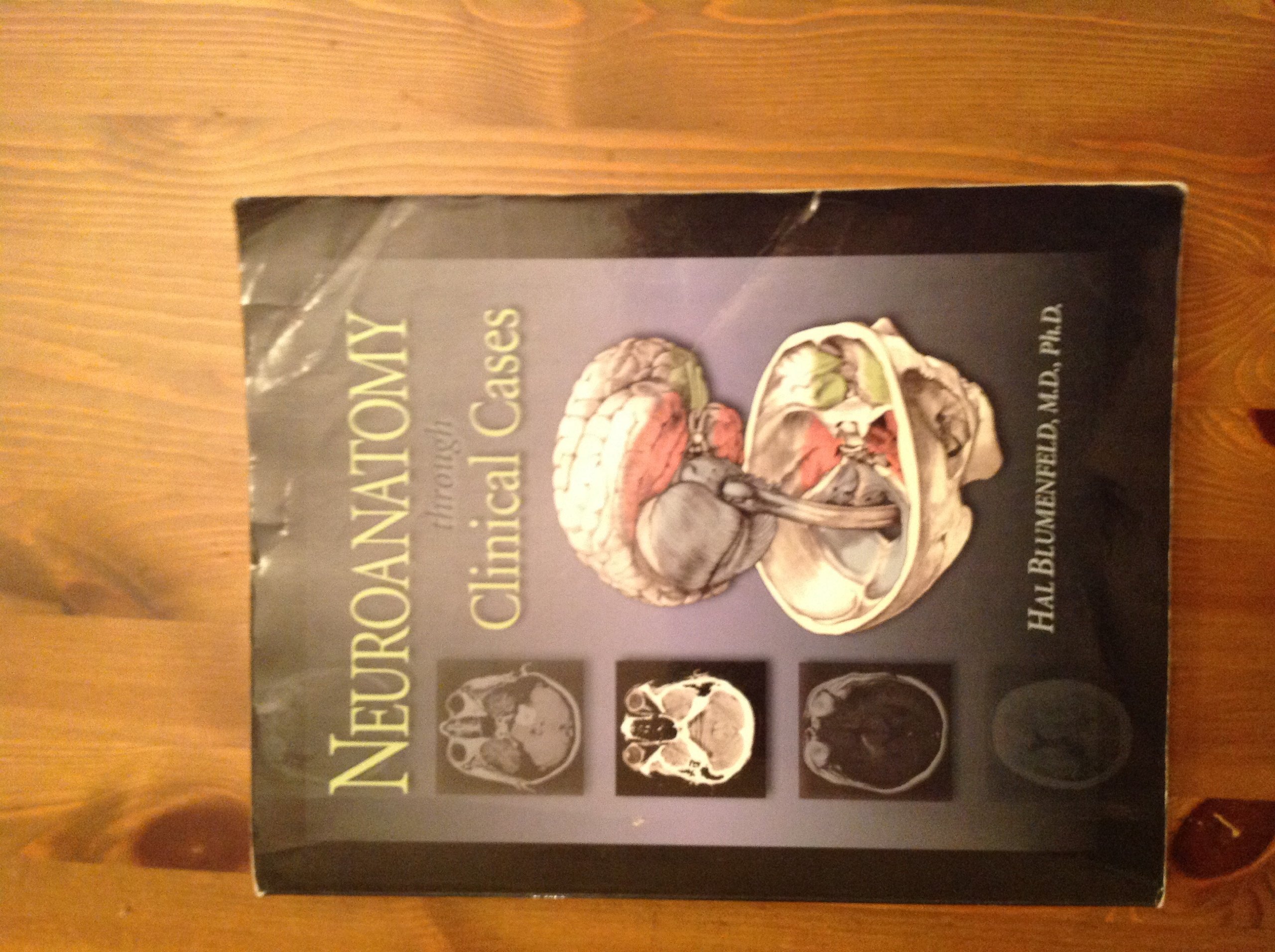 Neuroanatomy: Blumenfeld, Hal: 9780878930609: Books - Amazon.ca