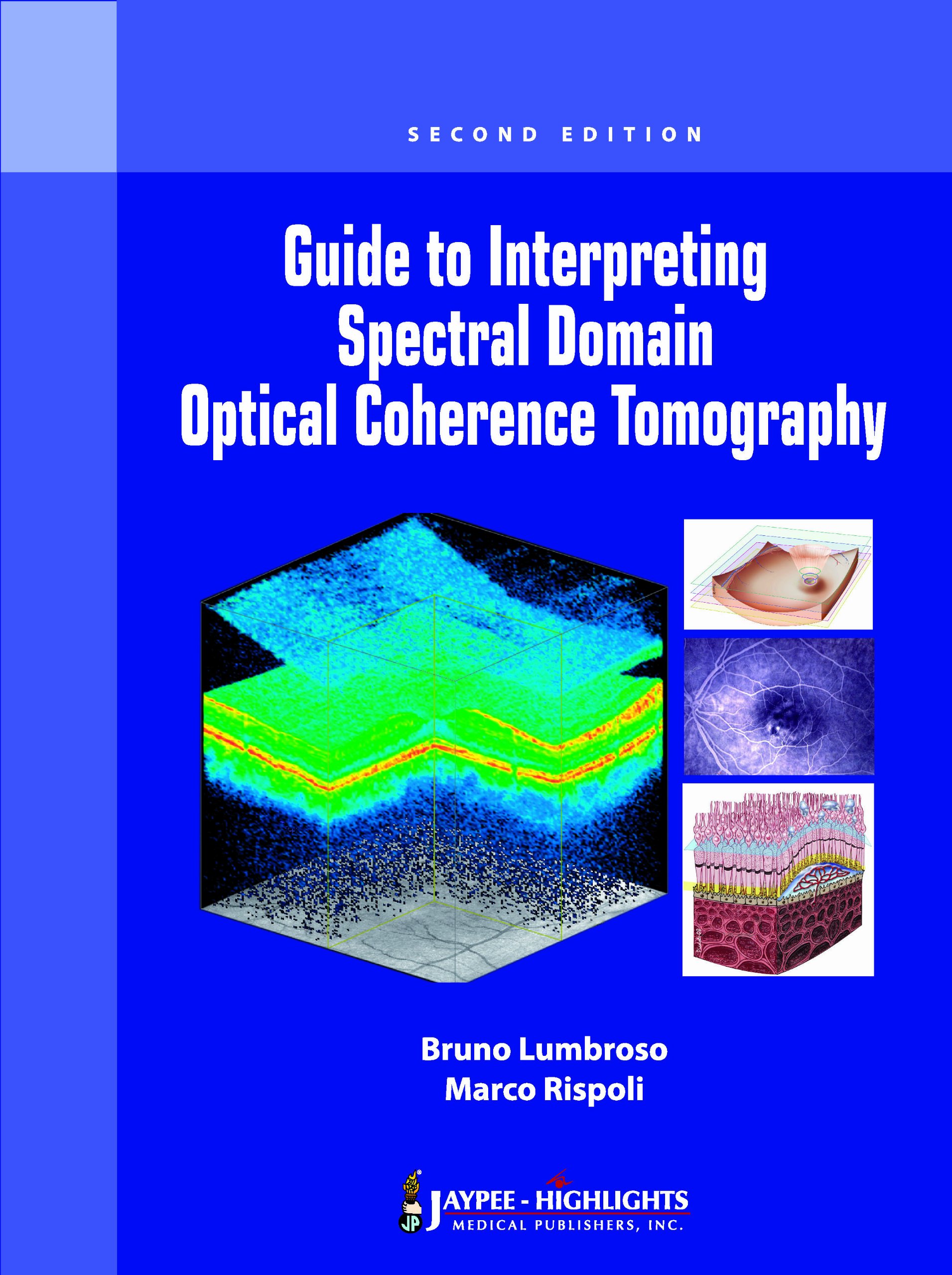 Guide to Interpreting Spectral Domain Optical Coherence Tomography ...