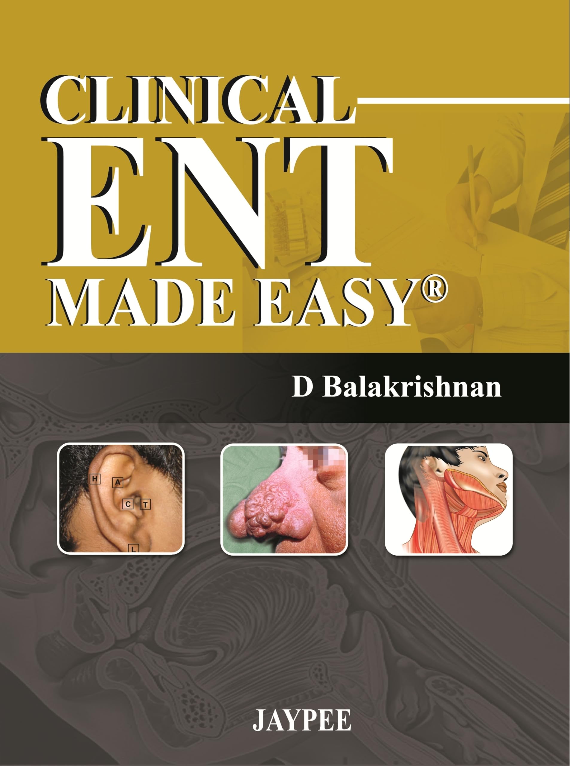 Clinical ENT Made Easy: A Guide to Clinical Examination: 9789350250846 ...