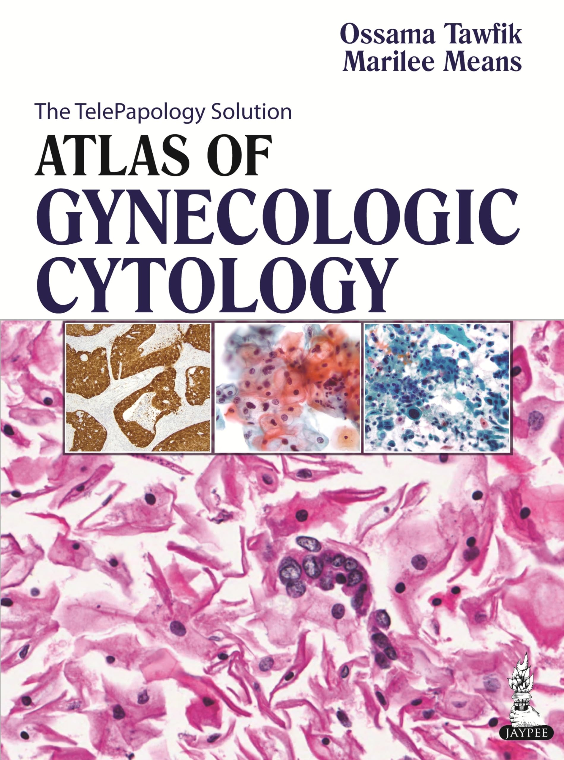 Atlas of Gynecologic Cytology: 9789350907757: Medicine & Health Science ...