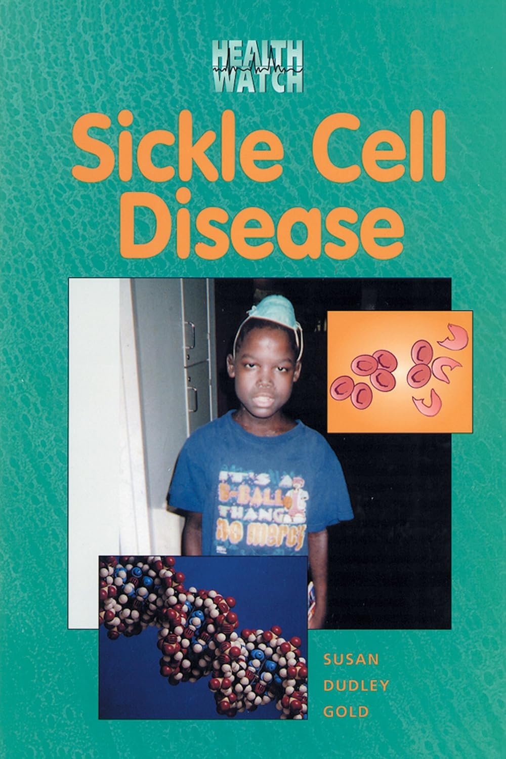 Sickle Cell Disease (Health Watch): Gold, Susan Dudley, McMahon ...