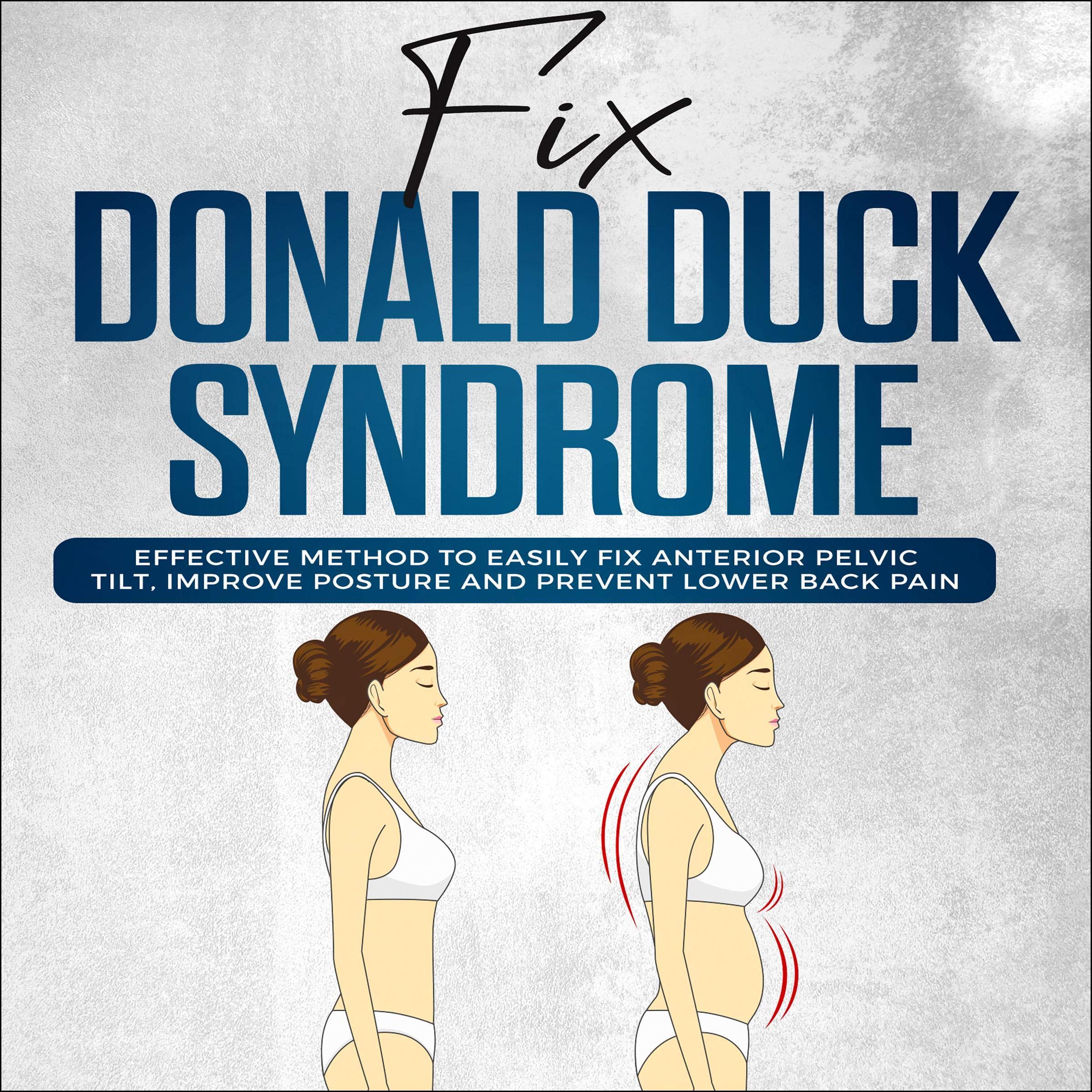 Buy Fix "Donald Duck" Syndrome: Effective Method to Easily Fix Anterior ...