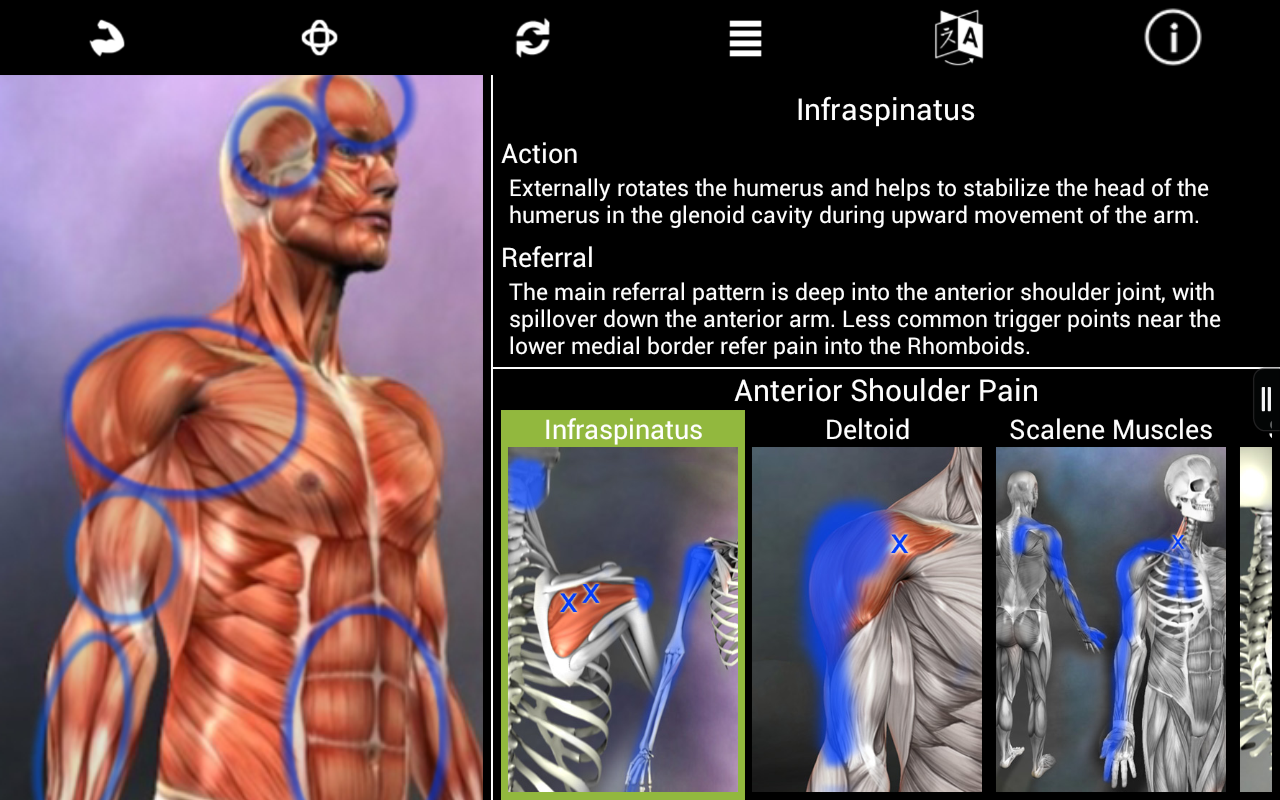 Muscle Trigger Point Anatomy: app su Amazon Appstore