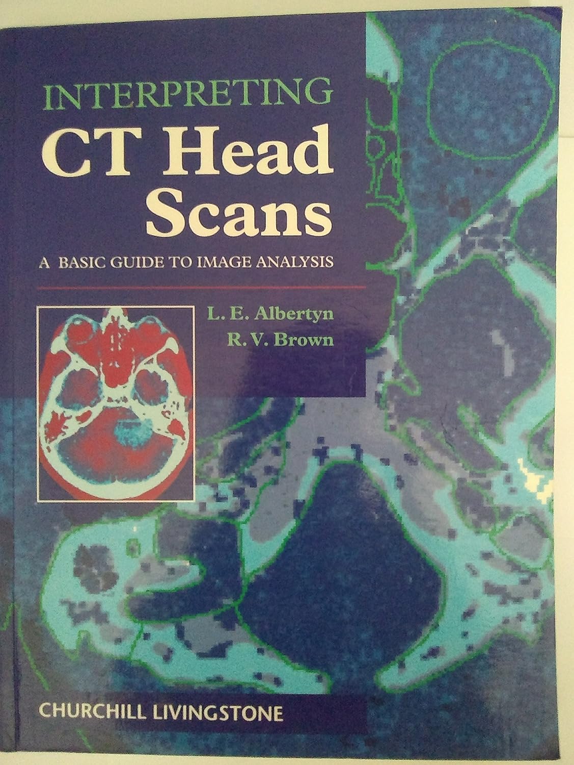 Interpreting CT Head Scans: A Basic Guide to Image Analysis ...