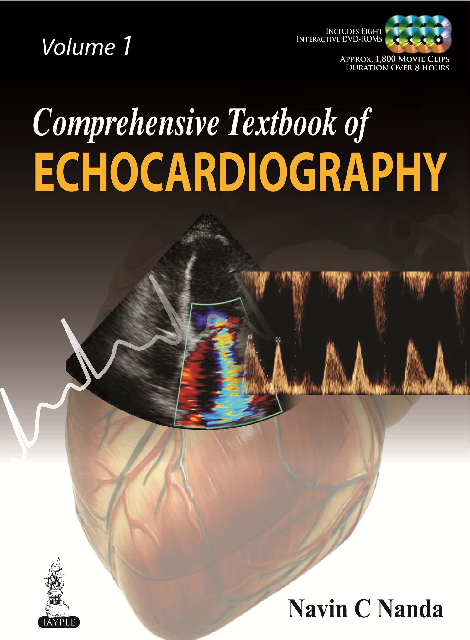 Buy Comprehensive Textbook Of Echocardiography (2 Vols) With Dvd-Roms ...