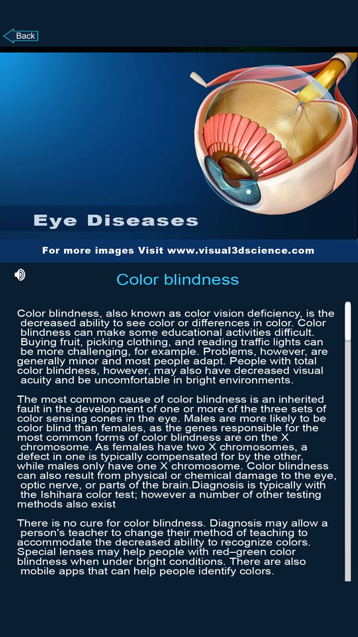 Eye Anatomy Pro. - App on Amazon Appstore