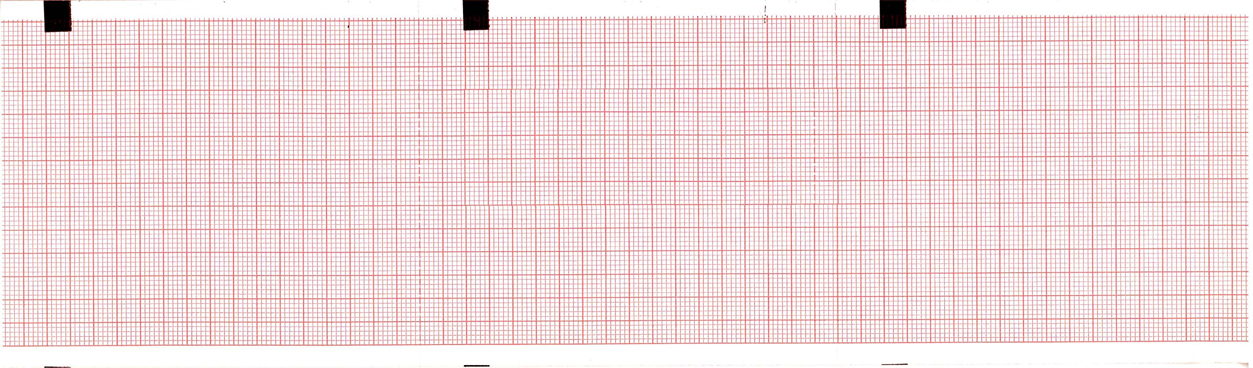 Ecg Paper 80mm X 90mm X 360sheet Works For Hellige | Desertcart INDIA