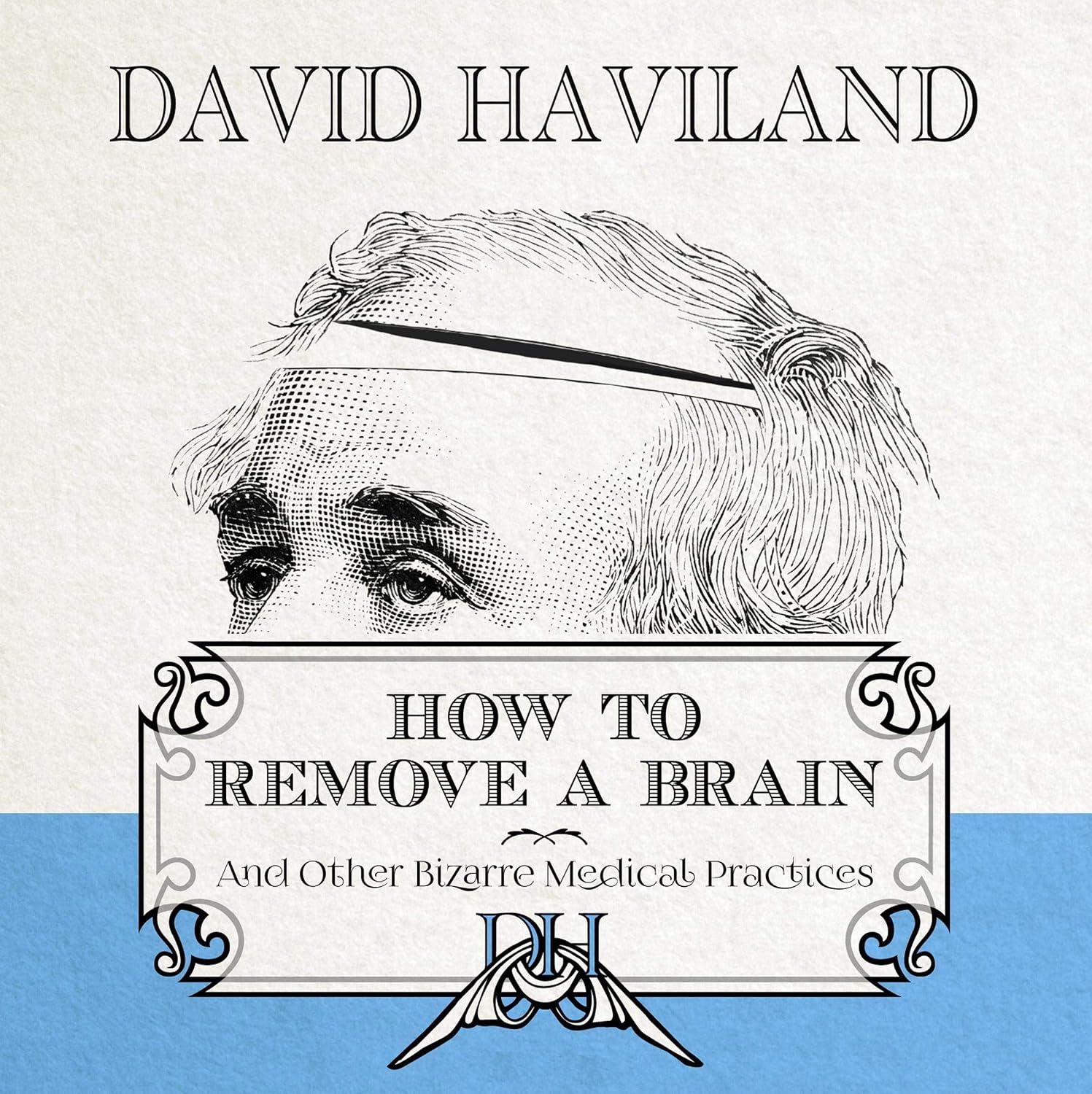 Amazon.com: How to Remove a Brain: And Other Bizarre Medical Practices ...
