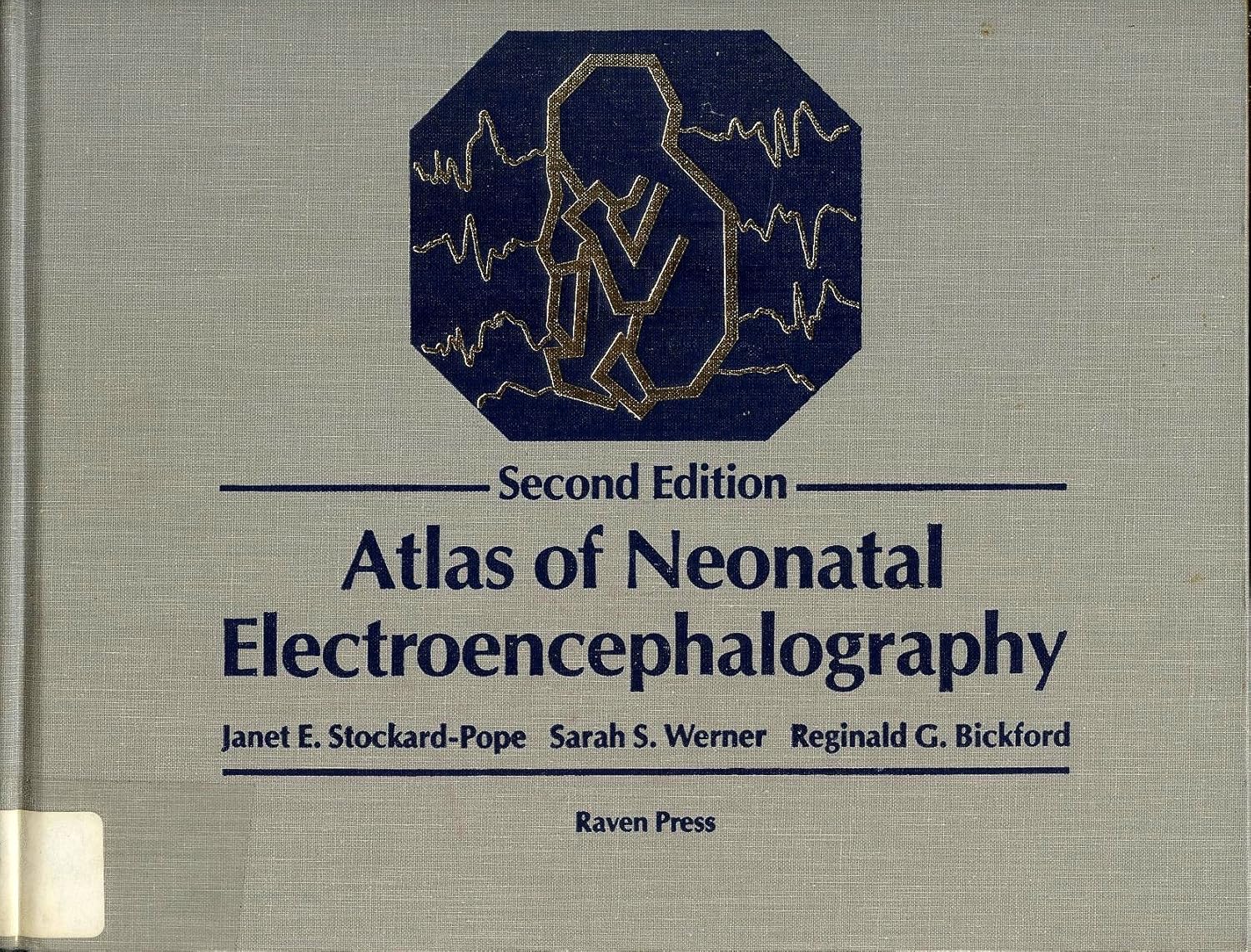 Amazon | Atlas of Neonatal Electroencephalography | Stockard-Pope ...