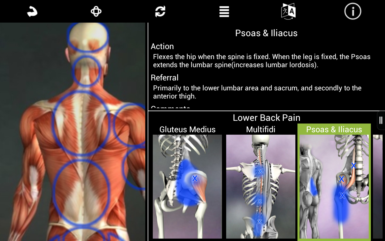 Muscle Trigger Point Anatomy - App on Amazon Appstore
