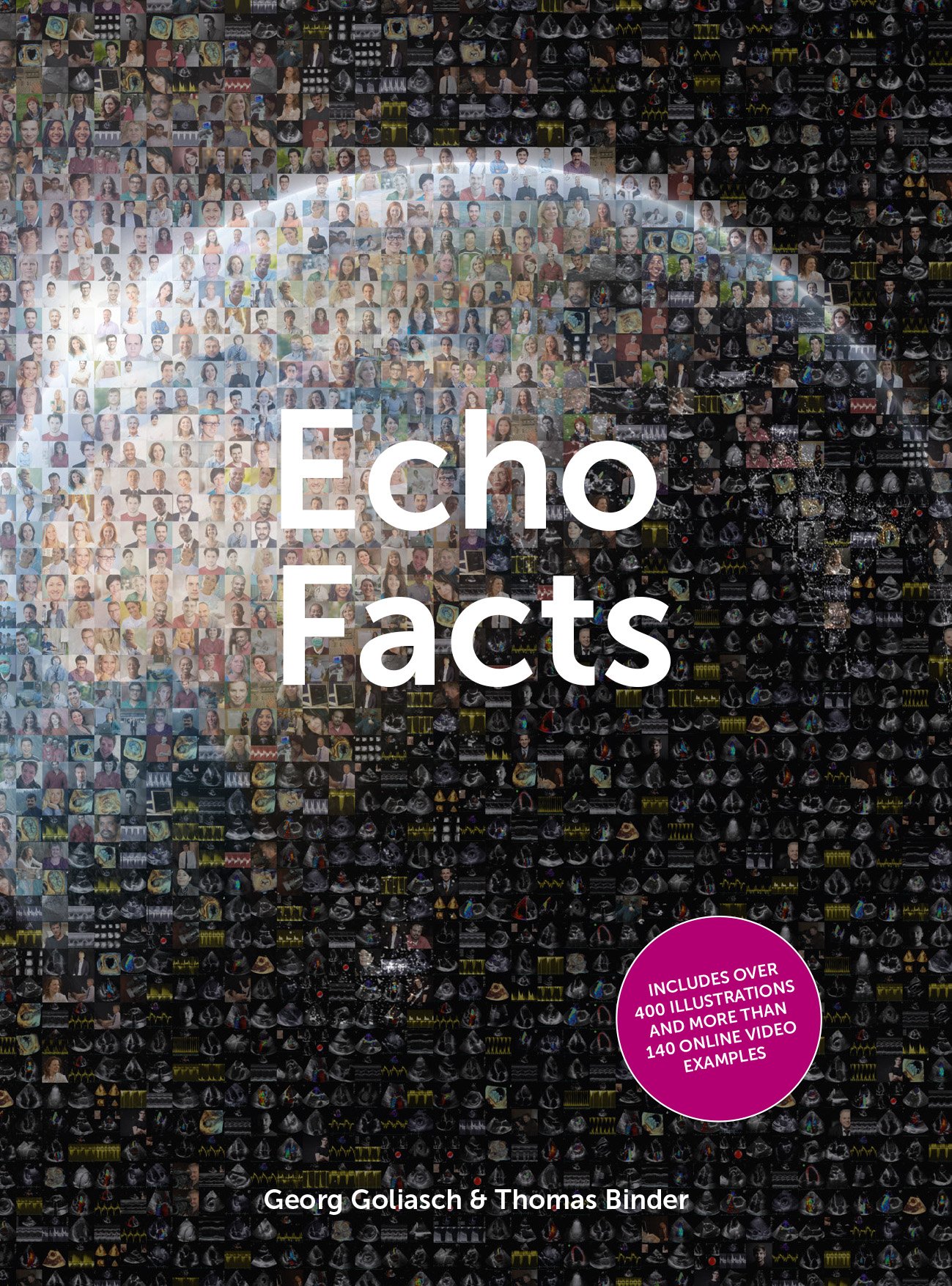 Echo Facts: the practical echocardiography companion for recent ...