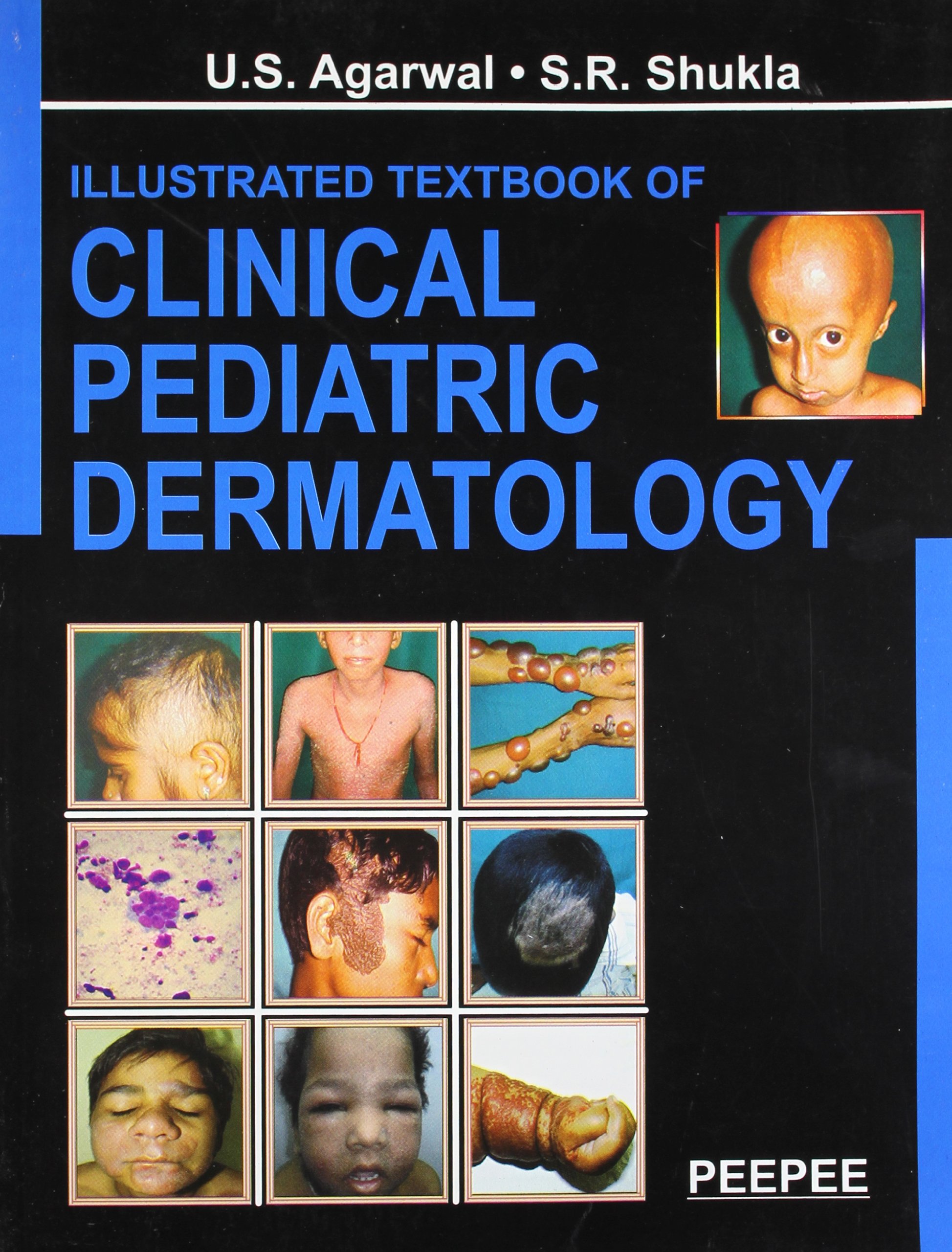 Buy Illustrated Textbook of Clinical Pediatric Dermatology: Volume 1 ...