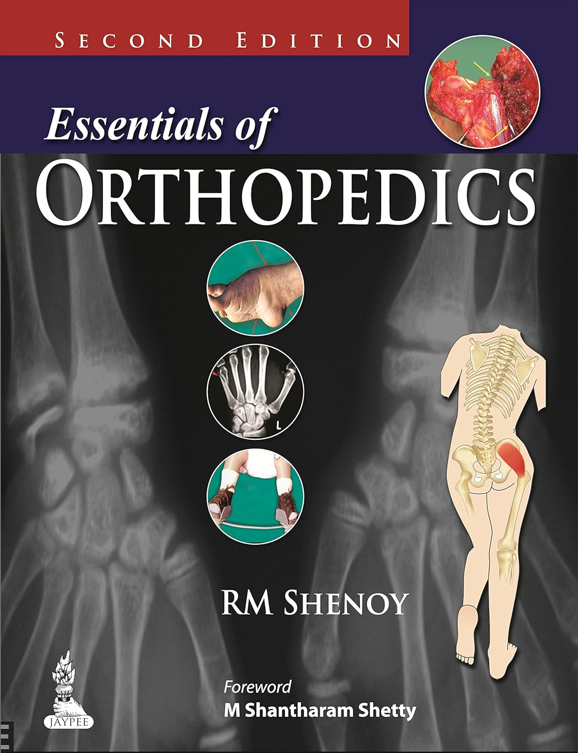 Essentials of Orthopedics: 9789350903735: Medicine & Health Science ...