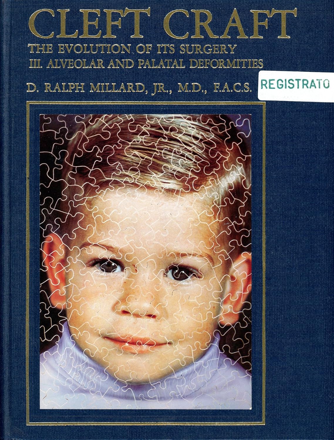 Cleft Craft: Alveolar and Palata and Deformities: 3 : Amazon.com.mx: Libros