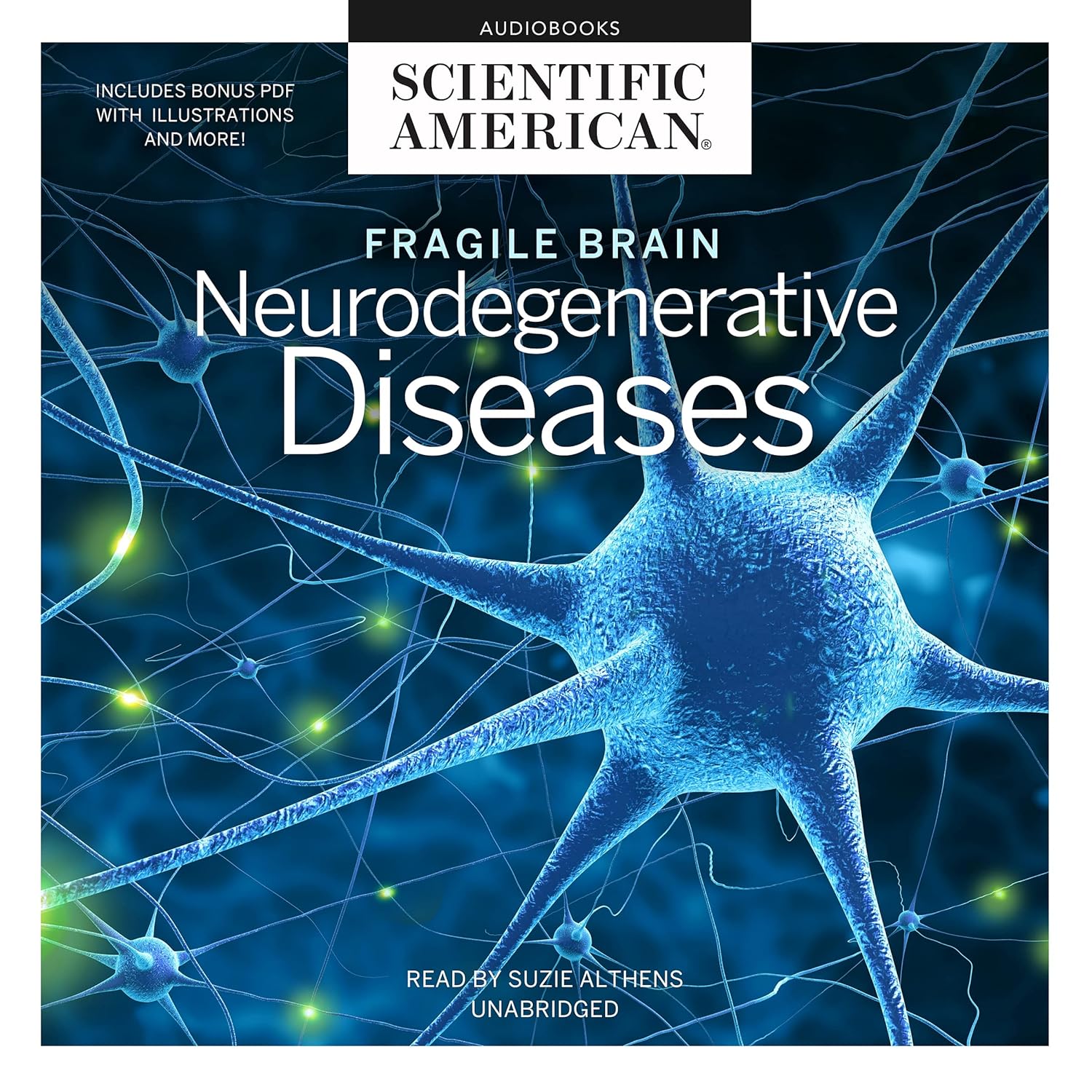 Buy Fragile Brain: Neurodegenerative Diseases Book Online at Low Prices ...