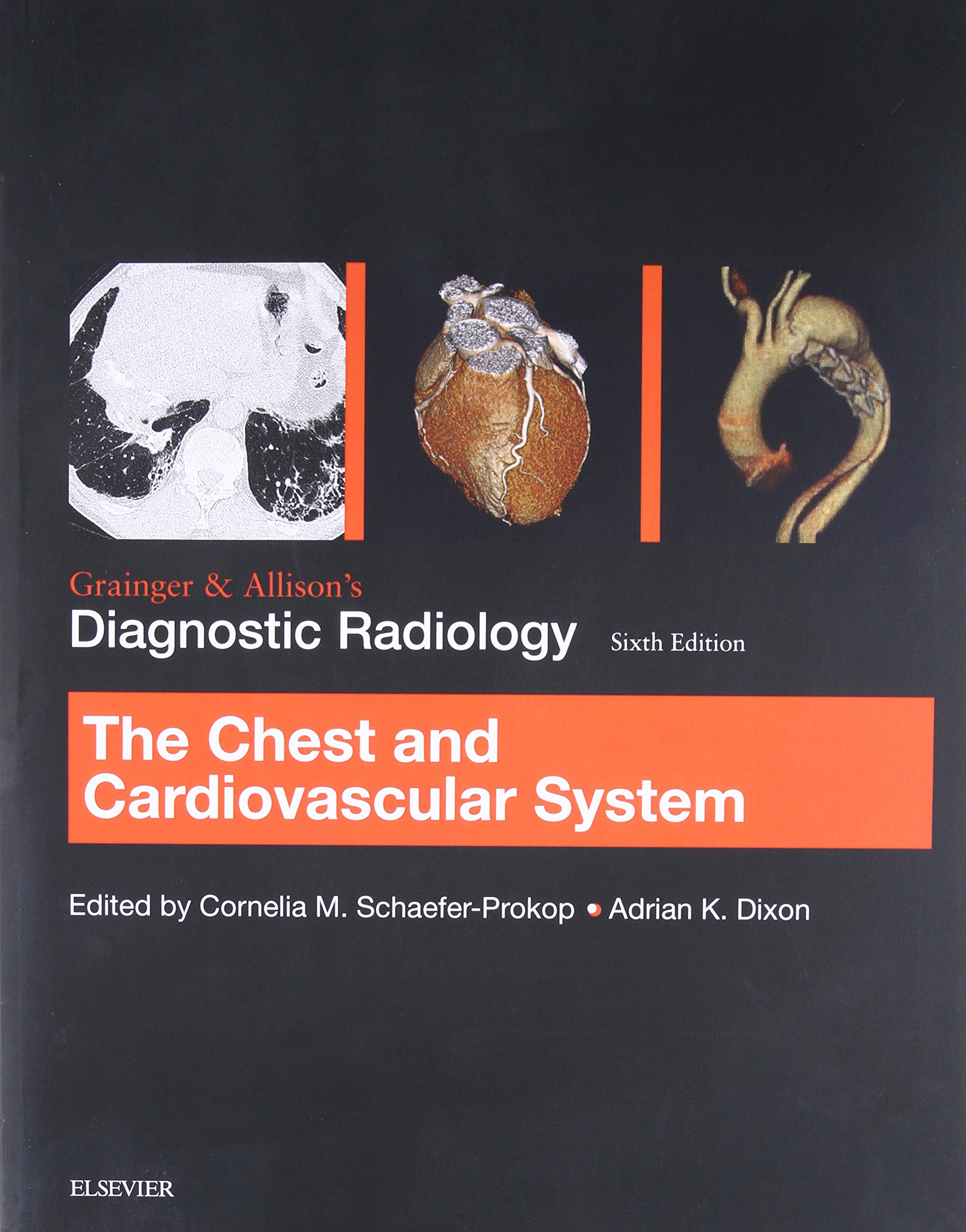 Grainger & Allison’s Diagnostic Radiology: Chest and Cardiovascular ...