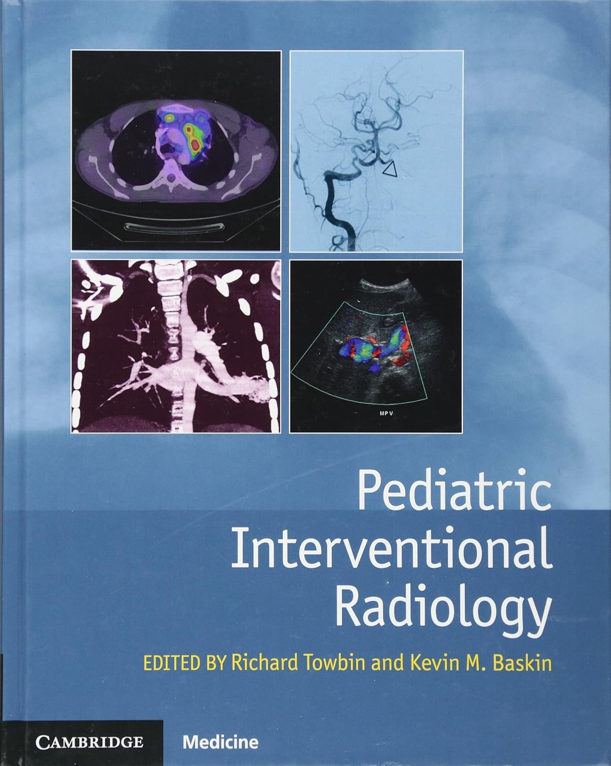 Pediatric Interventional Radiology: 9781107042629: Medicine & Health ...