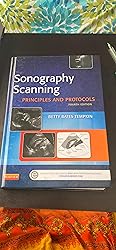 Sonography Scanning: Principles and Protocols (Ultrasound Scanning ...