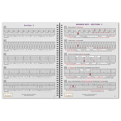 Snapklik.com : R-CAT EKG Workbook Series 1