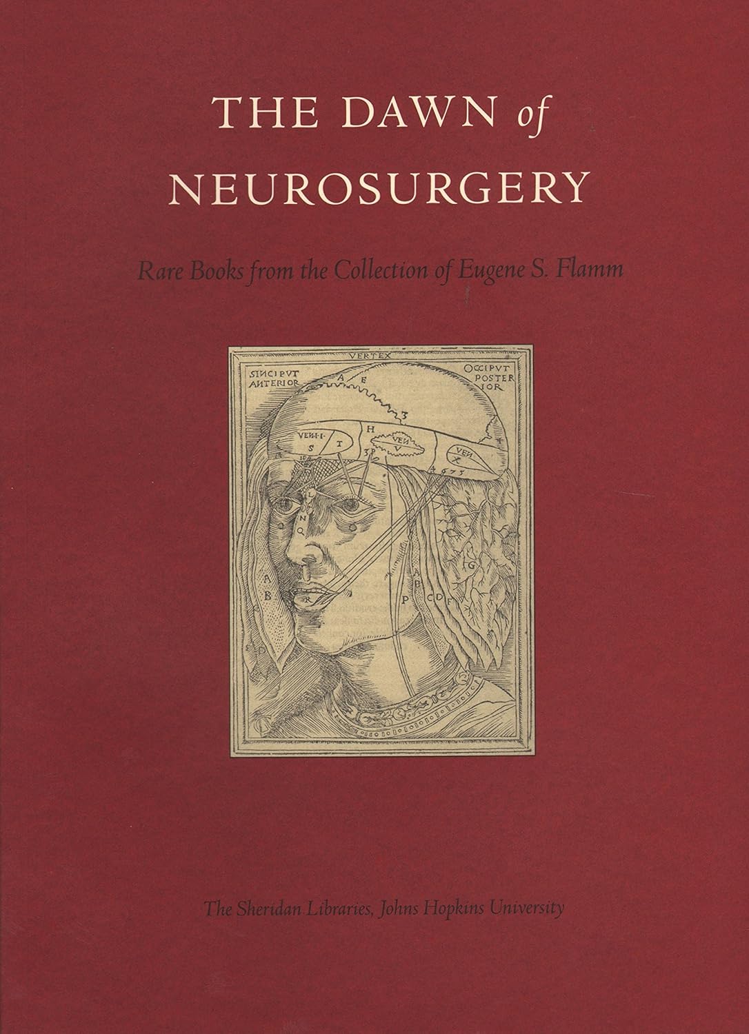 The Dawn of Neurosurgery: Rare Books From the Collection of Eugene S ...