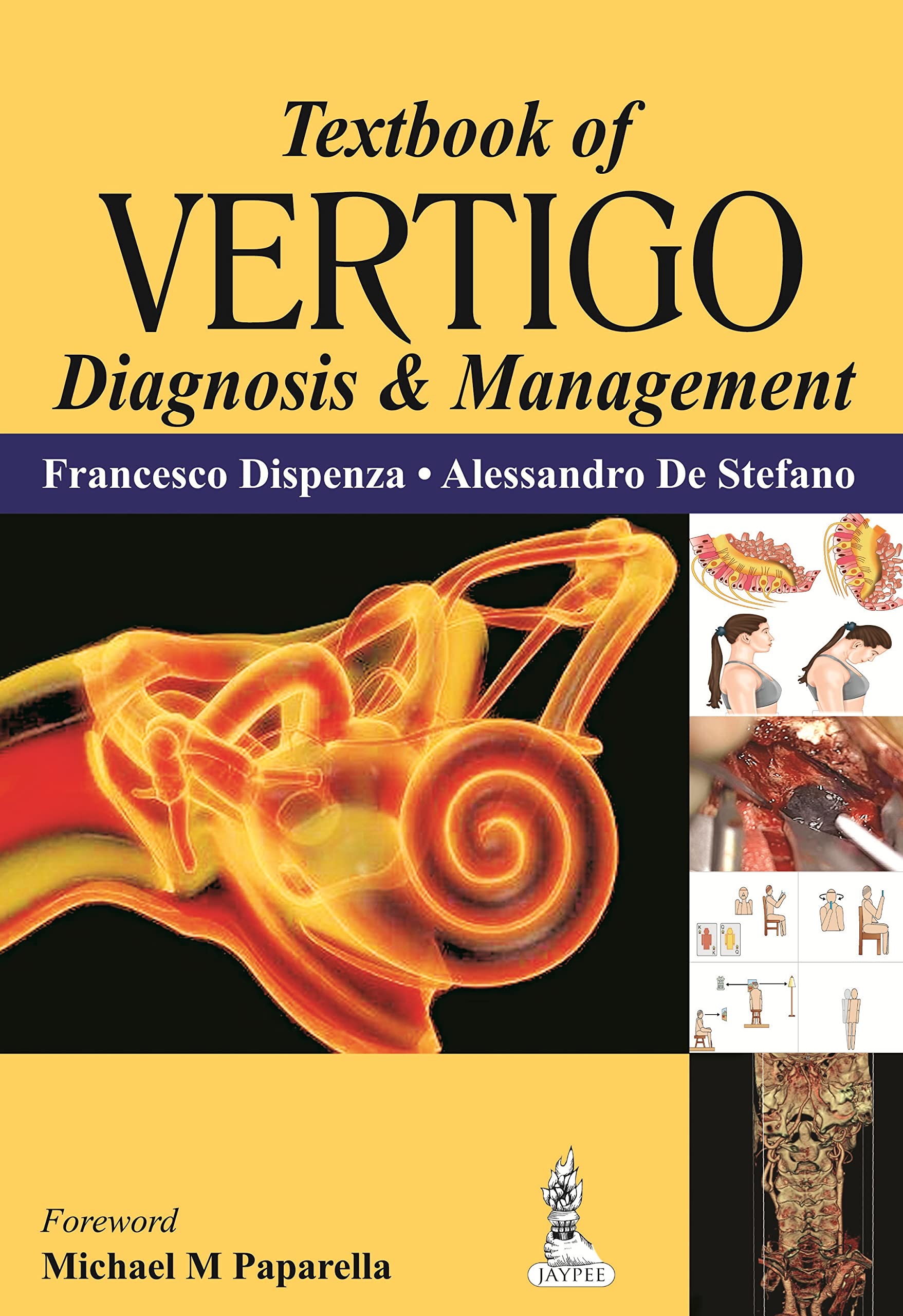Textbook of Vertigo: Diagnosis and Management: 9789350906729: Medicine ...
