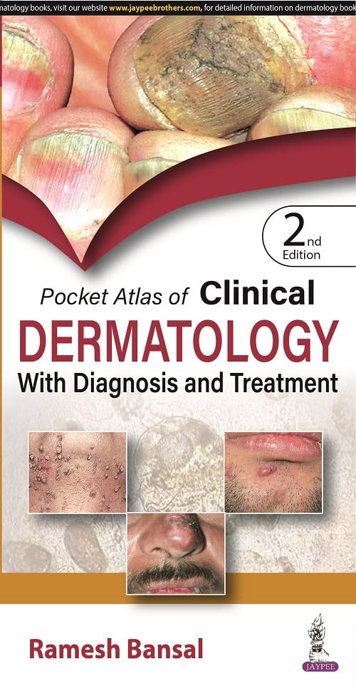 Buy Pocket Atlas of Clinical Dermatology with Diagnosis and Treatment ...