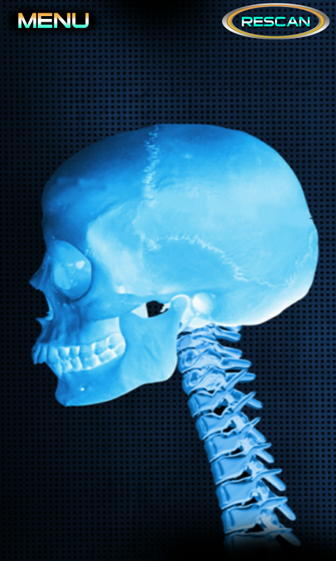 Scanner X-Ray Full Body - App on Amazon Appstore