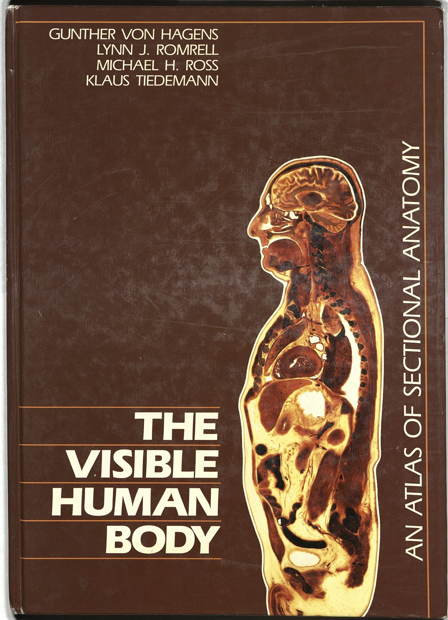 Visible Human Body: An Atlas of Sectional Anatomy: 9780812112696 ...